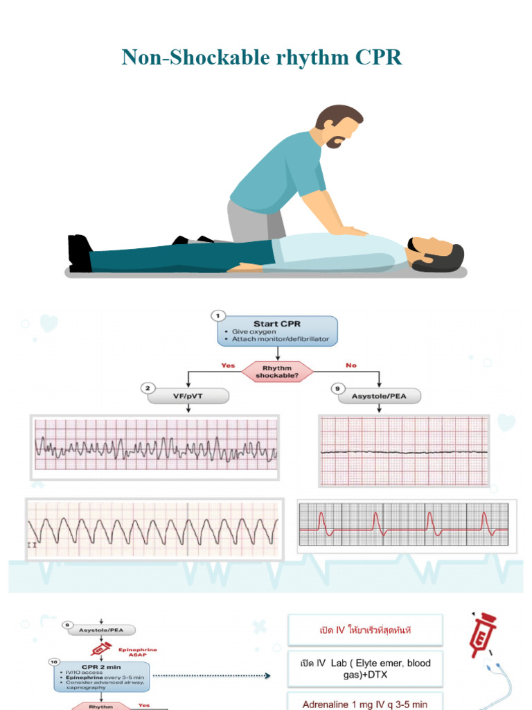 Non Shock CPR | PDF