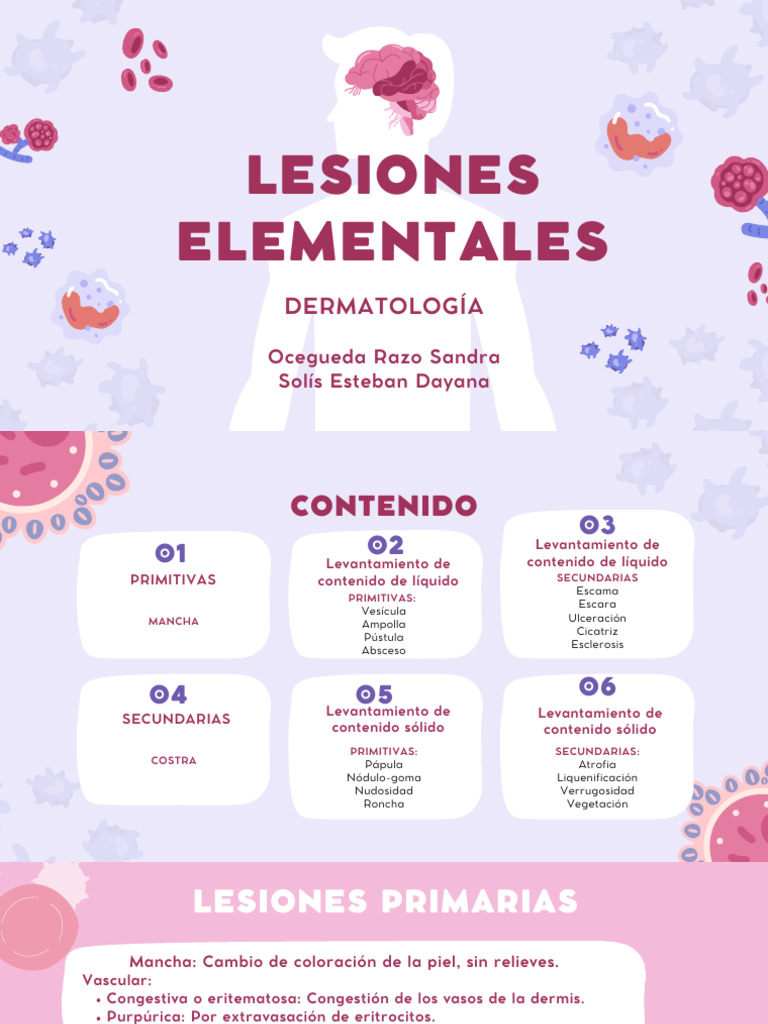 Lesiones Elementales, Solís DayanaOcegueda Sandra 3605 | PDF | Piel ...