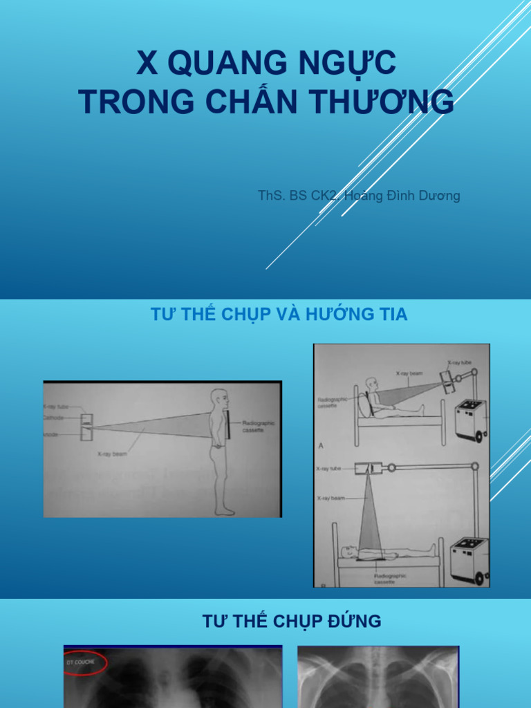 X QUANG NGỰC TRONG CHẤN THƯƠNG KNLS2 Y3 Y2021 năm học 2023 2024 - Ths.BsCK2.Hoàng Đình Dương | PDF