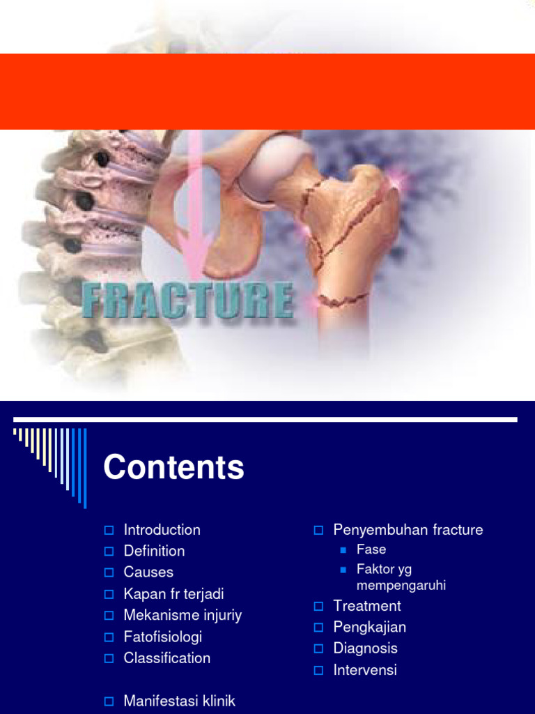 KMB Fracture | PDF