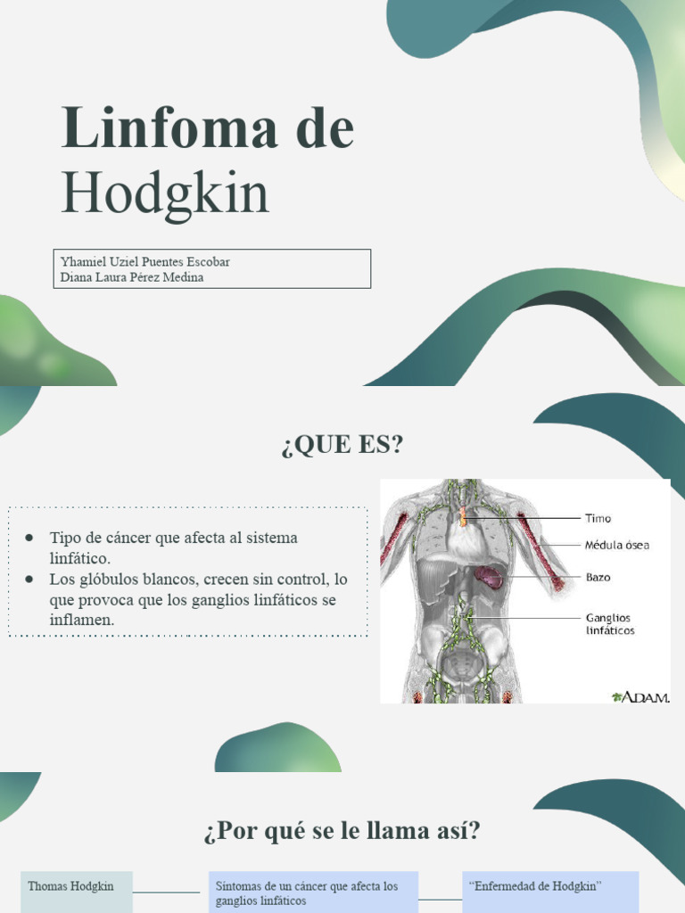 Linfoma de Hodgkin | PDF | Cáncer | Linfoma