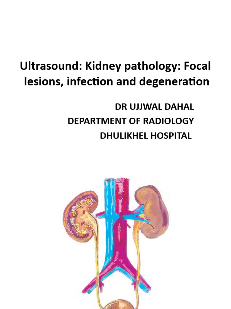 Kidneys Focal Lesions, Degeneration and Inflammation | PDF | Kidney ...