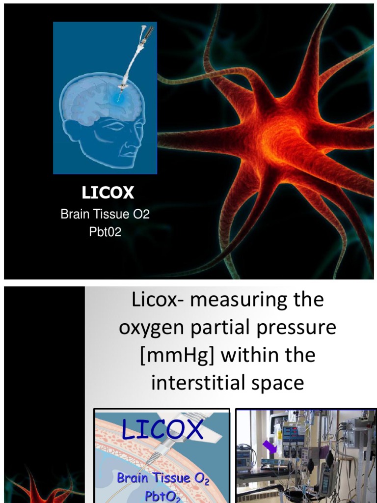 Licox: Brain Tissue O2 Pbt02 | PDF