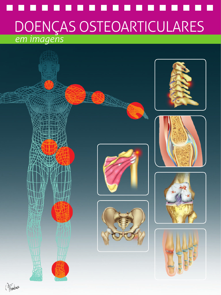 0arth1502002 Guia Imagens Osteoarticulares v1 | PDF | Osteoartrite ...