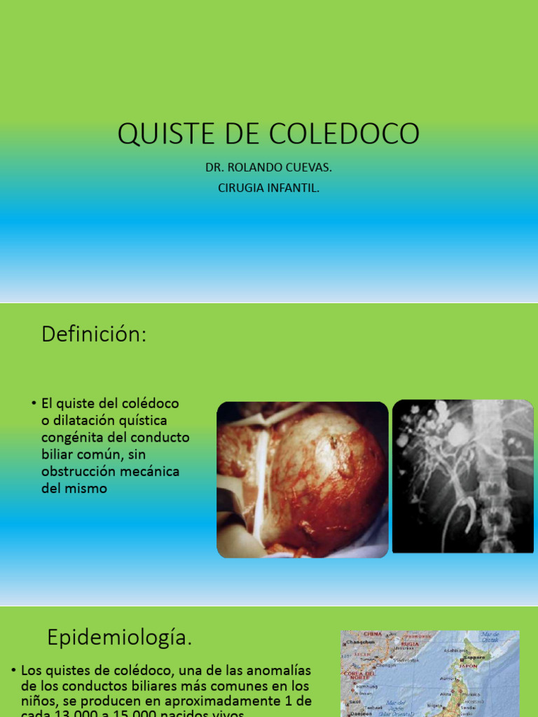 Quistedecoledoco 191124203930 | PDF | Sistema exocrino | Enfermedades y ...