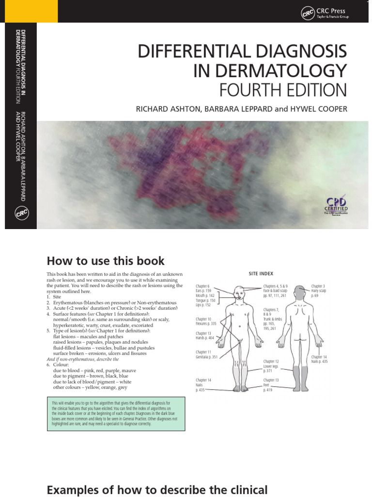 Differential Diagnosis in Dermatology | PDF | Dermatitis | Skin