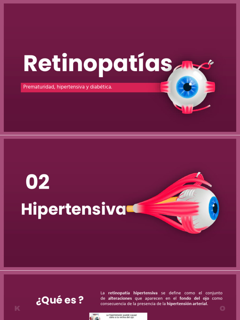 Retinopatia hipertensiva | PDF | Enfermedades y trastornos humanos ...