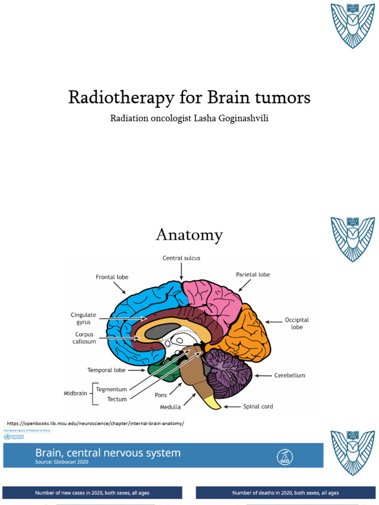 Brain Tumors | PDF