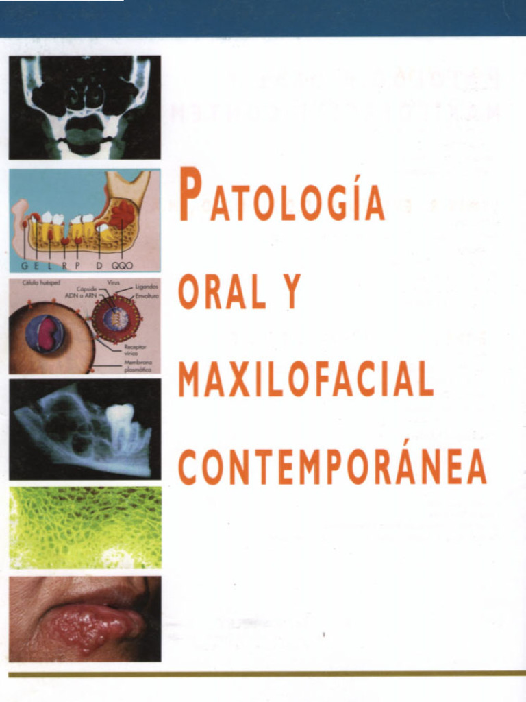 Patología Oral y Maxilo Facial Contemporánea | PDF
