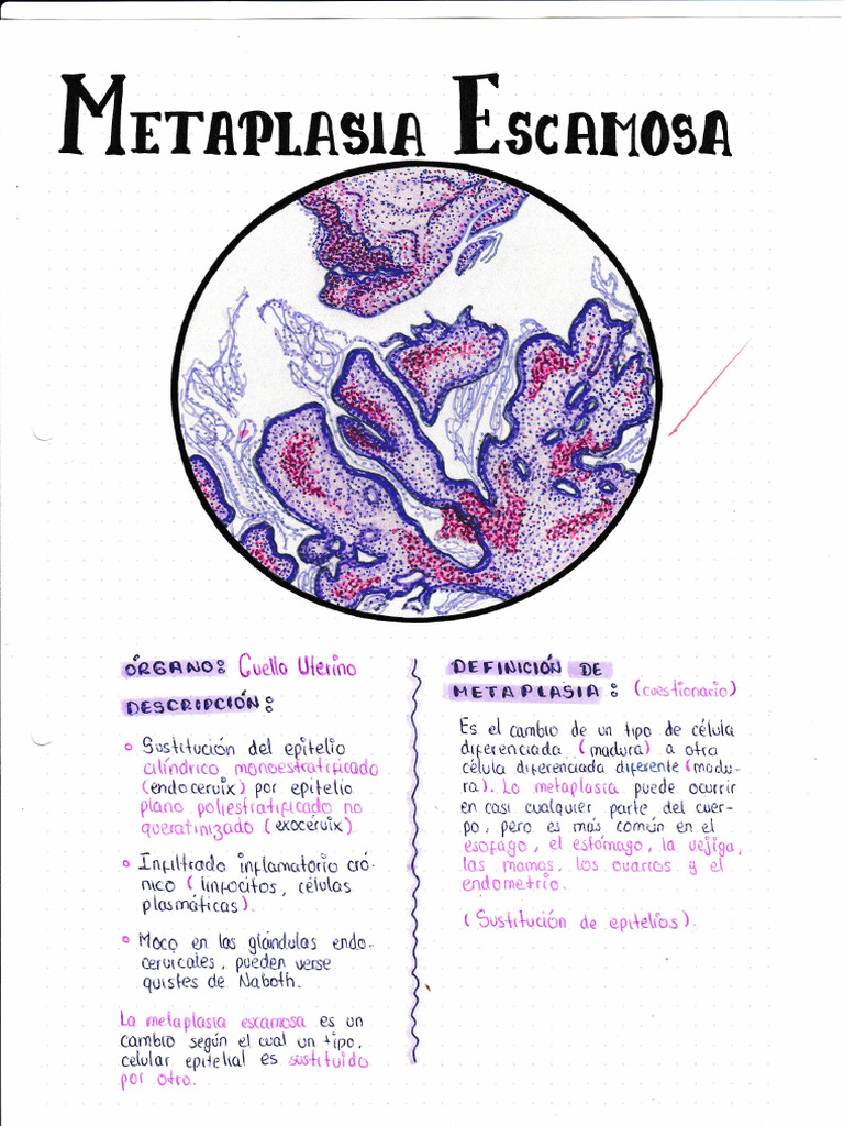 Metaplasia Escamosa: Definición y Aspectos | PDF | Libros para adolescentes