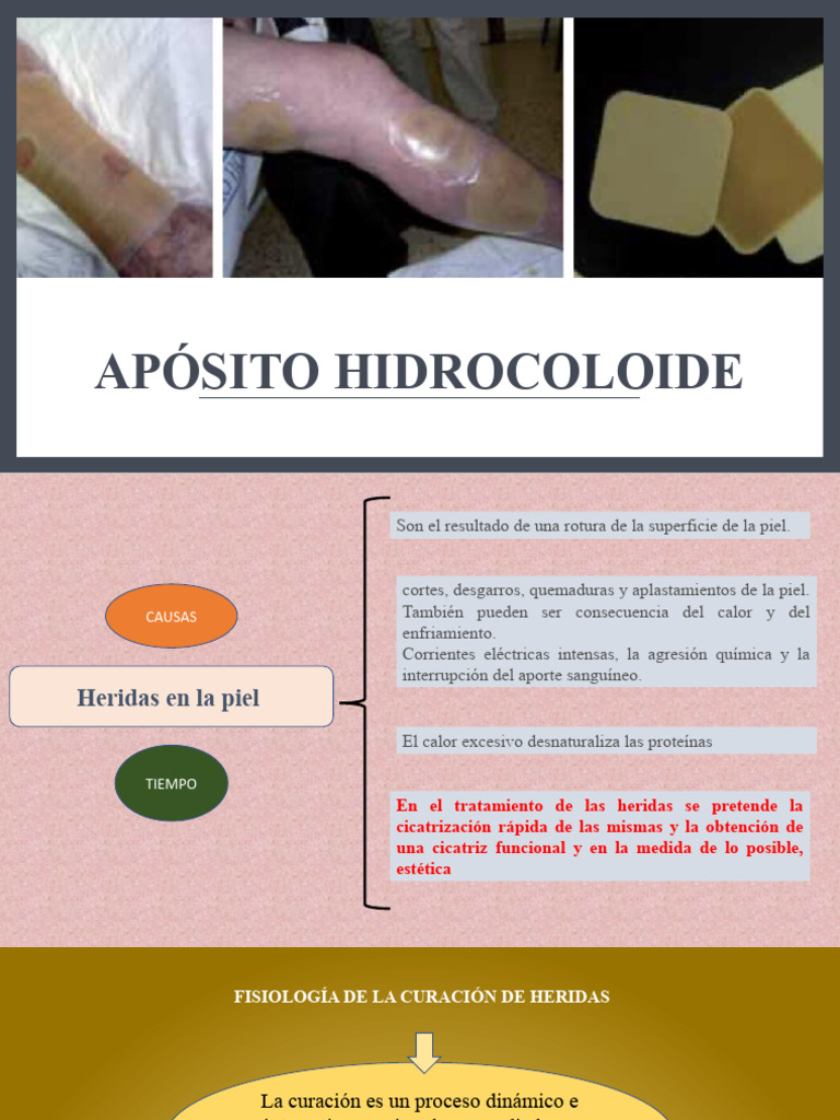 App Hidrocolo Ide (Autoguardado) | PDF