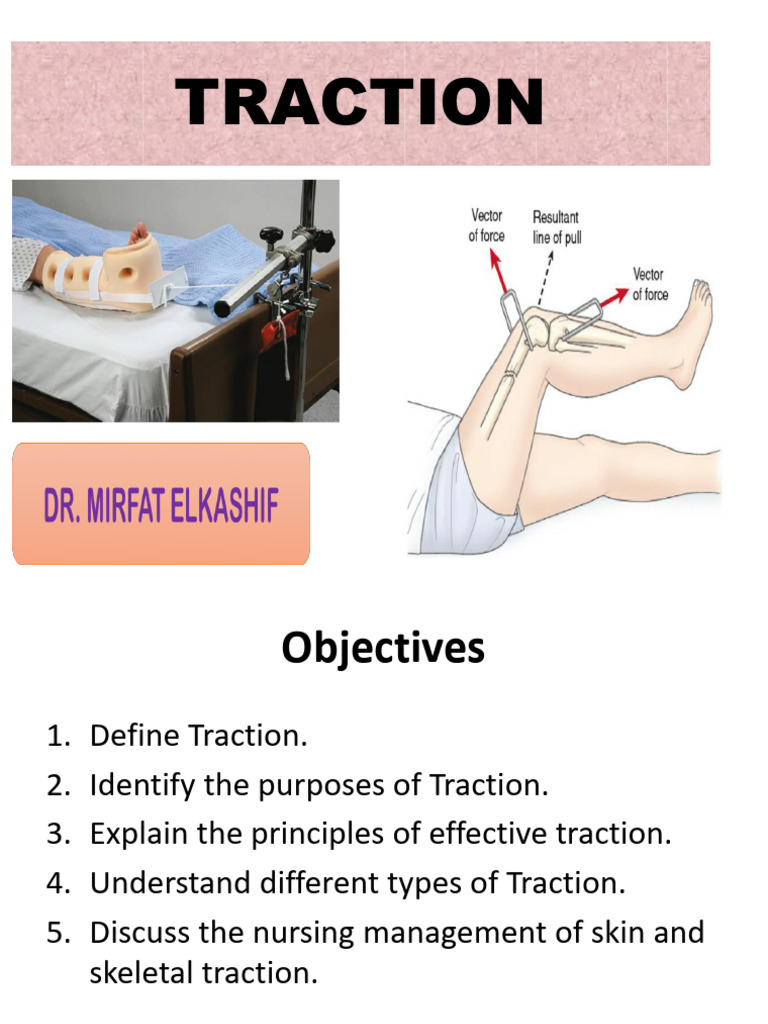 Traction | PDF | Surgery | Skeletal Muscle
