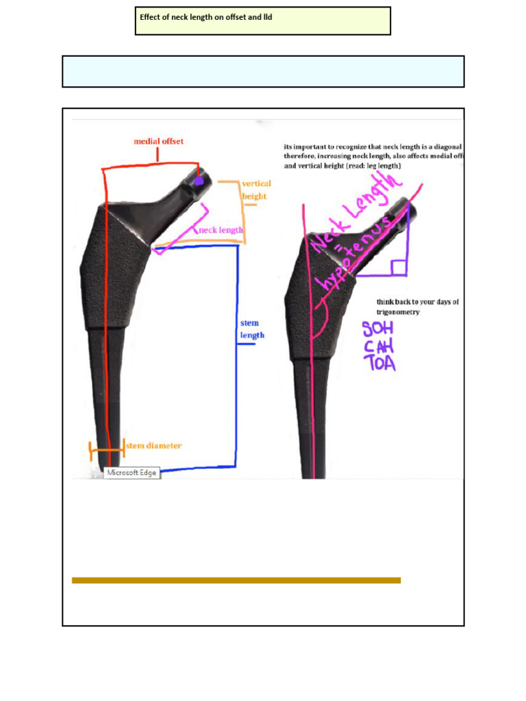 Effect of Neck Length On Offset and LLD | PDF