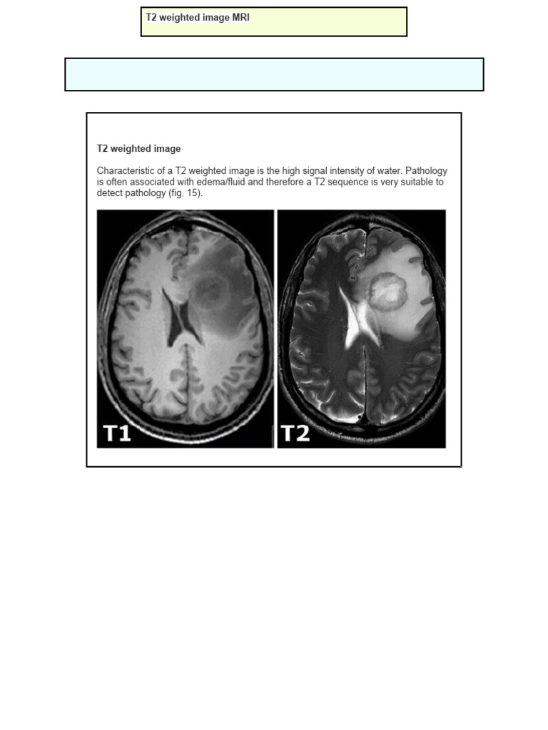 T2 Weighted Image MRI | PDF