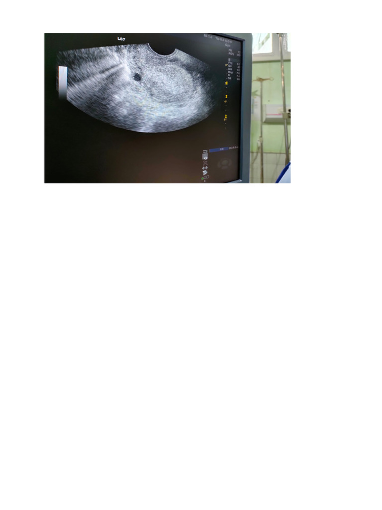 Hasil Usg Pasien | PDF
