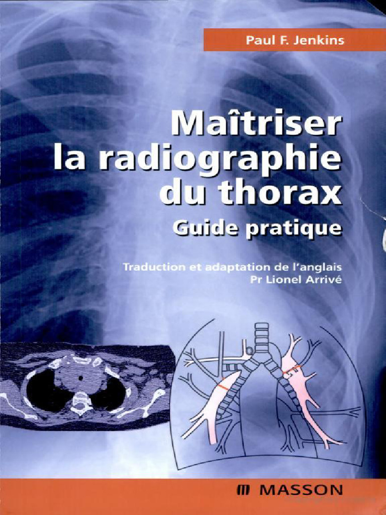 Maîtriser La Radiographie Du Thorax Guide Pratique | PDF
