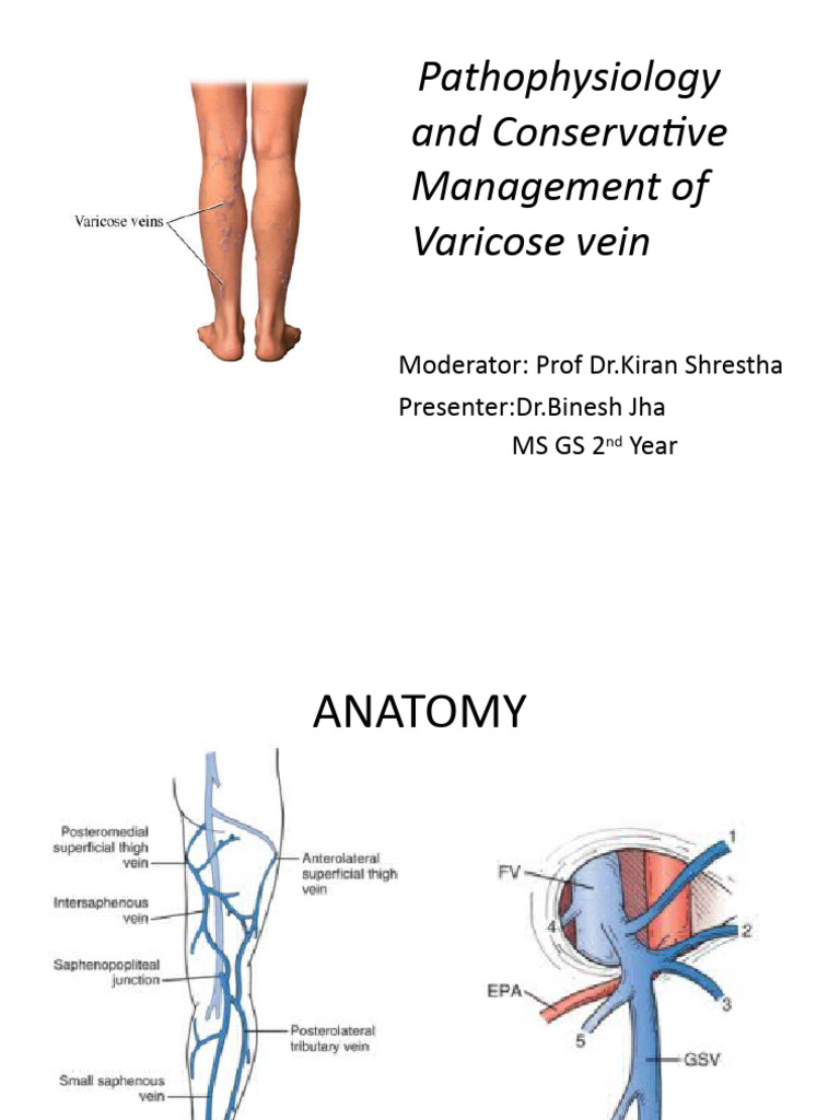 Pathophysiology and Conservative Management of Varicose Vein | PDF | Vein | Edema