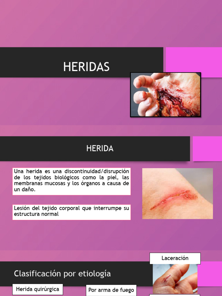 HERIDAS | PDF | Herida | Cicatrización de la herida