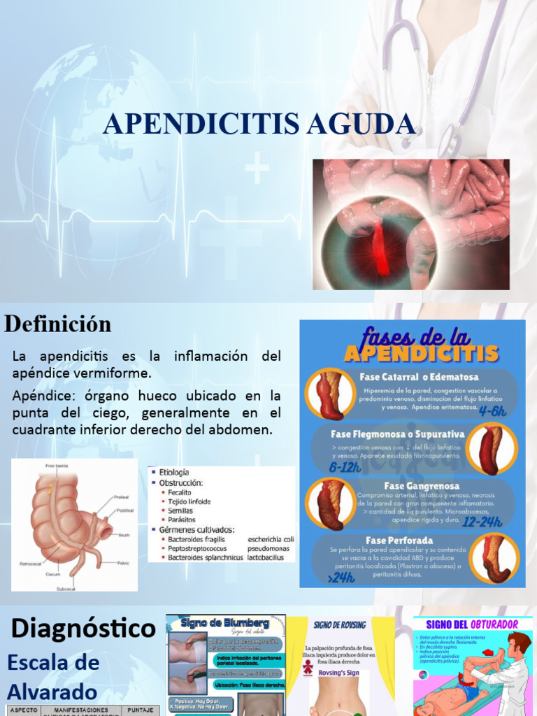 Apendicitis Aguda | PDF