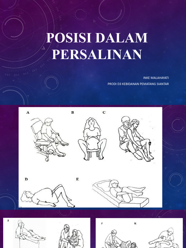 Posisi Dalam Persalinan | PDF Posisi Dalam Persalinan | PDF