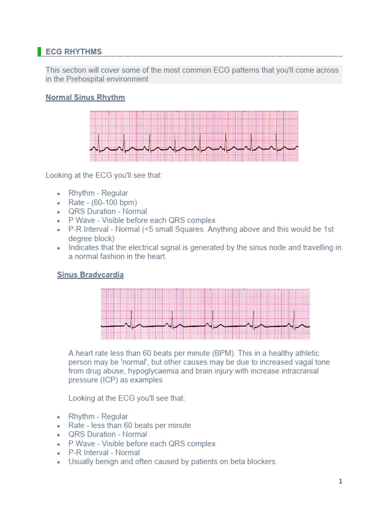 Ecg Rhythms | PDF | Electrocardiography | Heart
