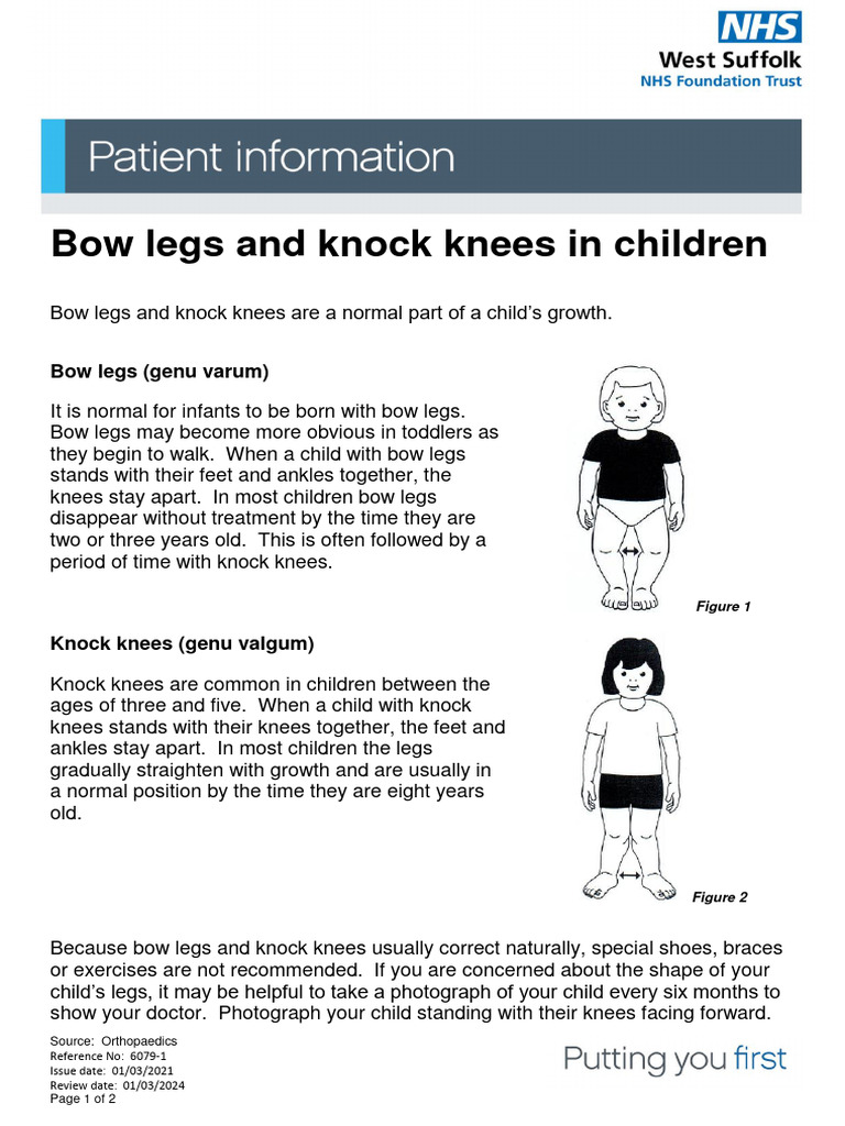 6079 1 Bow Legs and Knock Knees in Children | PDF