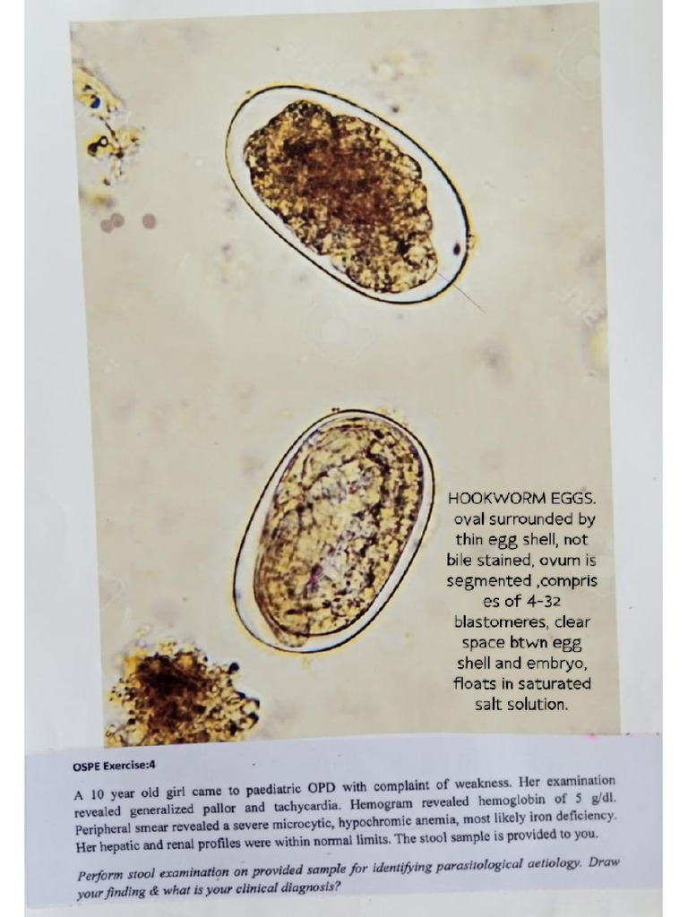 Micro Charts - Stool Examination | PDF