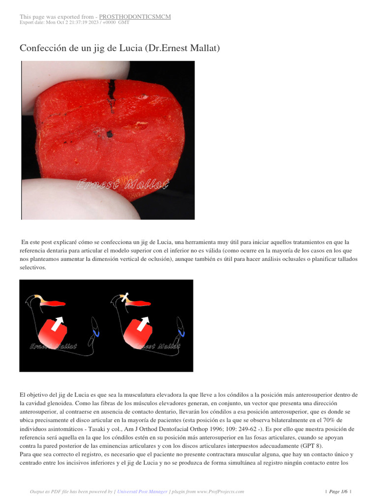 Confección del Jig de Lucia en Odontología | PDF