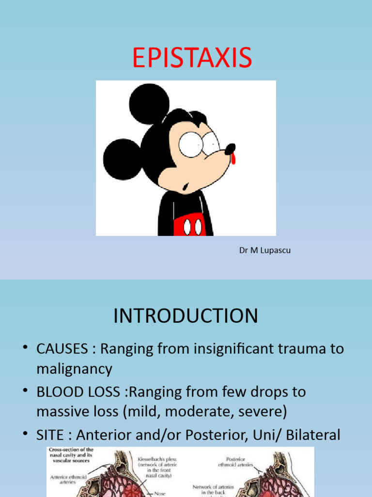 Epistaxis | PDF | Bleeding | Clinical Medicine