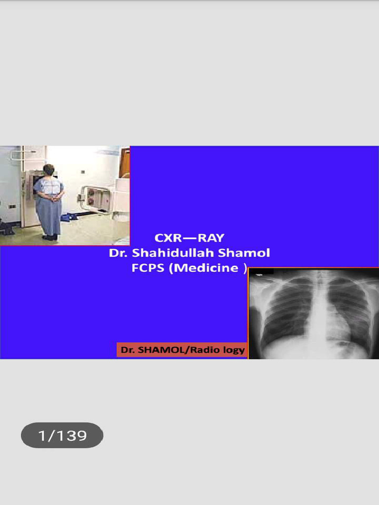 Shamol Radiology | PDF