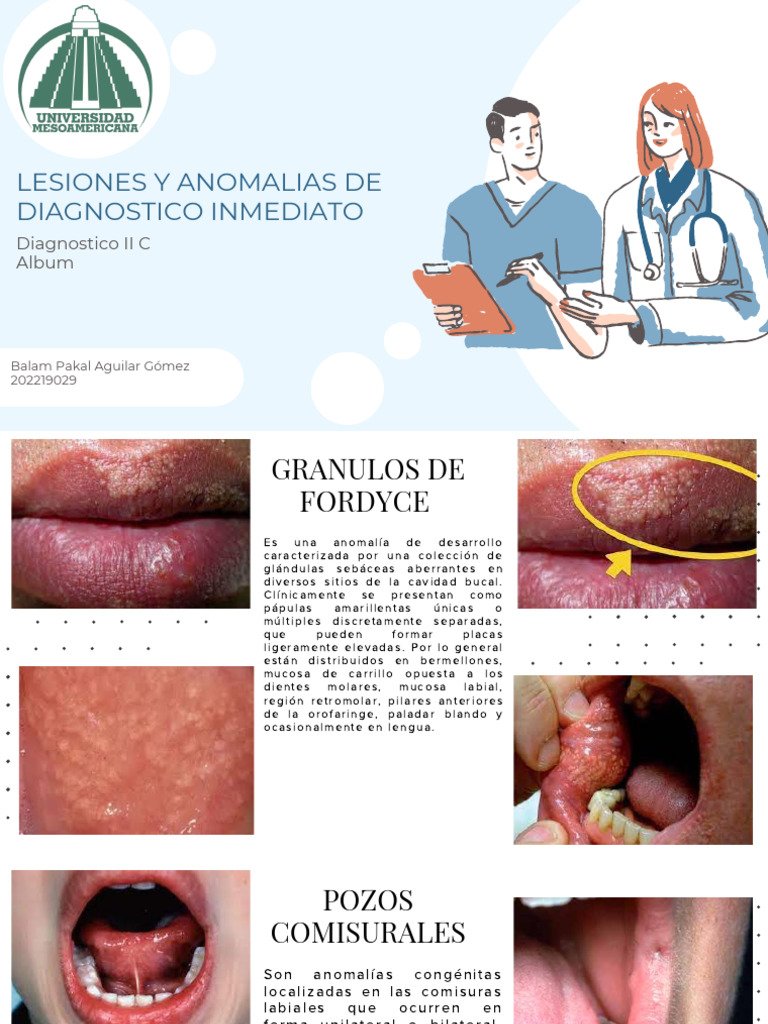Lesiones y Anomalías Bucales | PDF | Especialidades Medicas | Medicina ...