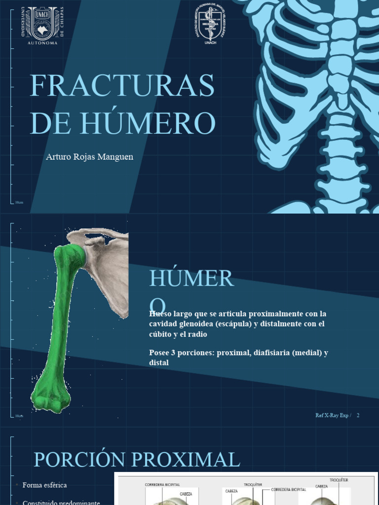 Fracturas de Húmero | PDF | Anatomía | Sistema esquelético