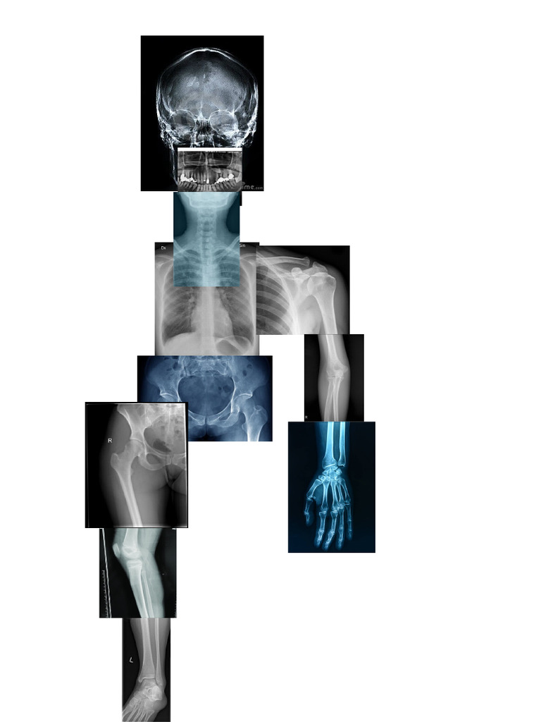 Xray Body Parts | PDF