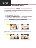 Restauração Dentária Classe III: Guia Prático | PDF