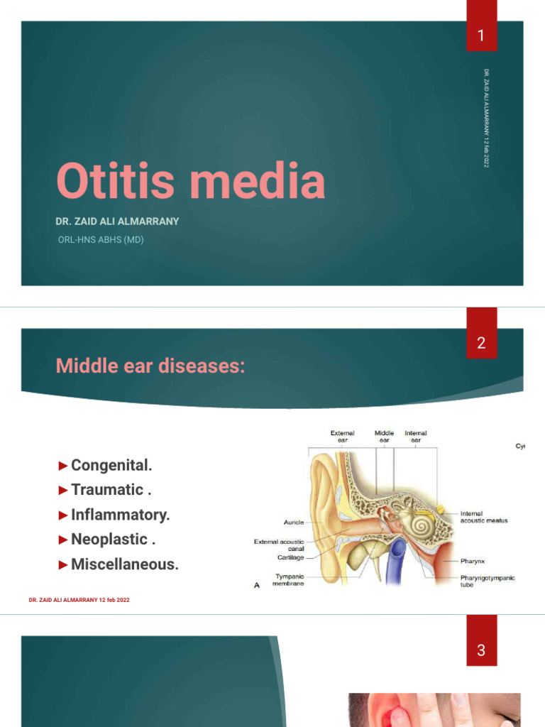 Otitis Media 21 | PDF | Epidemiology | Microbiology