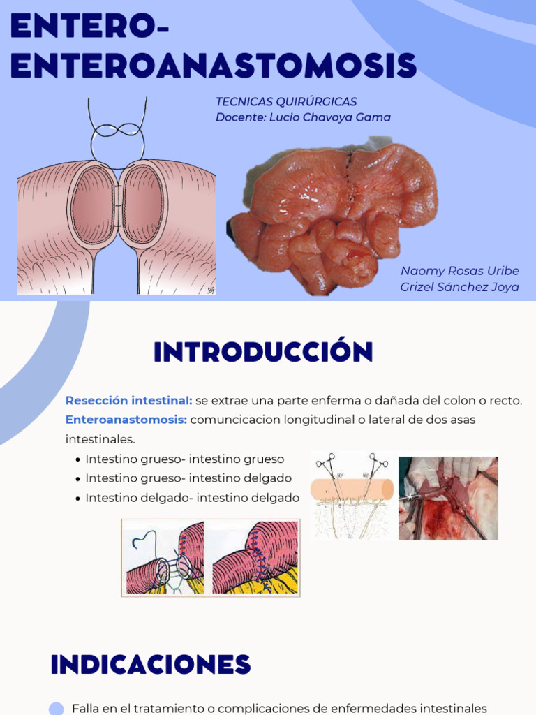 Entero Enteroanastomosis | PDF | Tracto gastrointestinal | Intestino grueso