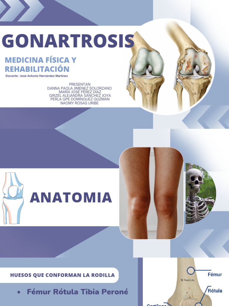 Gonartrosis | PDF | Rodilla | Sistema esquelético