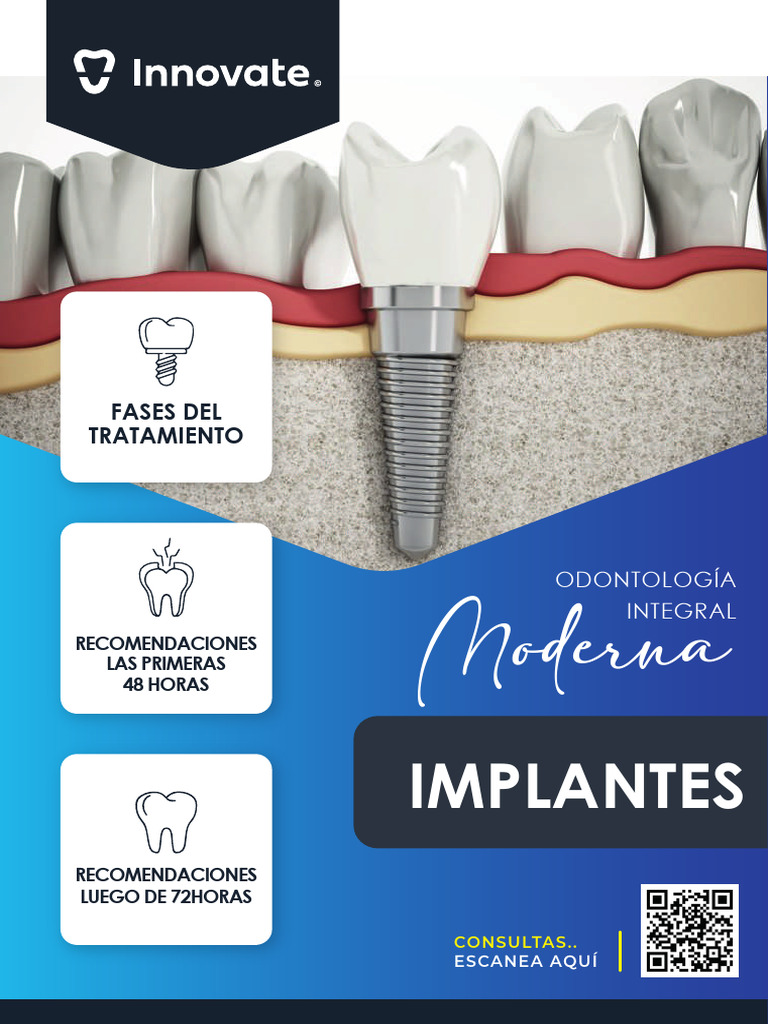 Folleto Informativo de Implantes | PDF