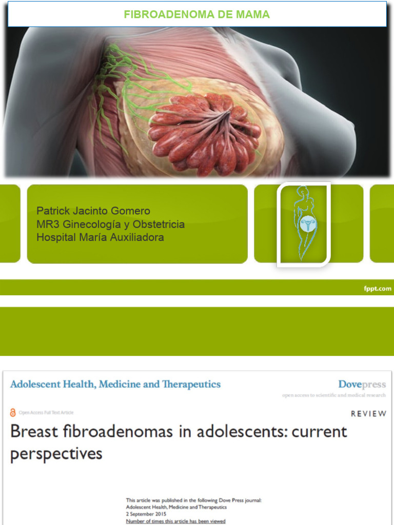 Fibroadenoma de Mama | PDF
