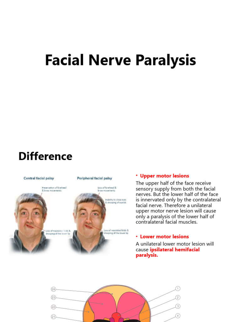 Facial Nerve Paralysis | PDF | Human Anatomy | Human Head And Neck