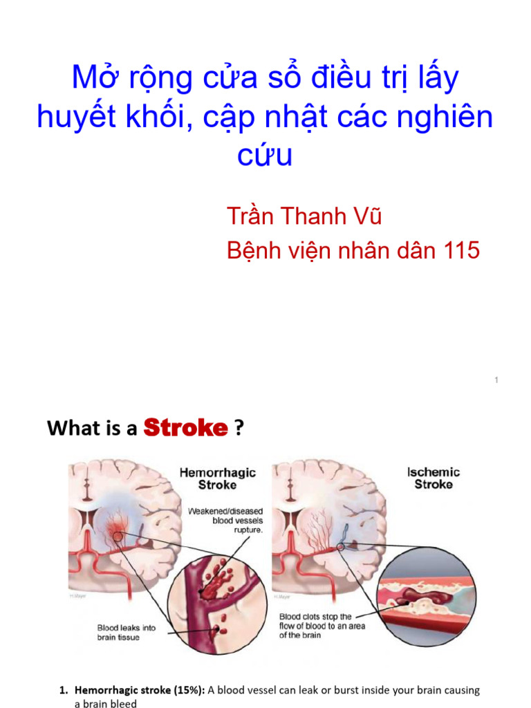 BS - ck2 Tran Thanh Vu Mo Rong Cua So Dieu Tri Cap Nhat Cac Guidlines | PDF
