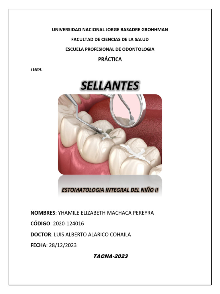 SELLANTES | PDF | Diente | Odontología