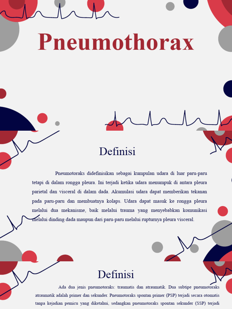 Pneumothorax CSS | PDF
