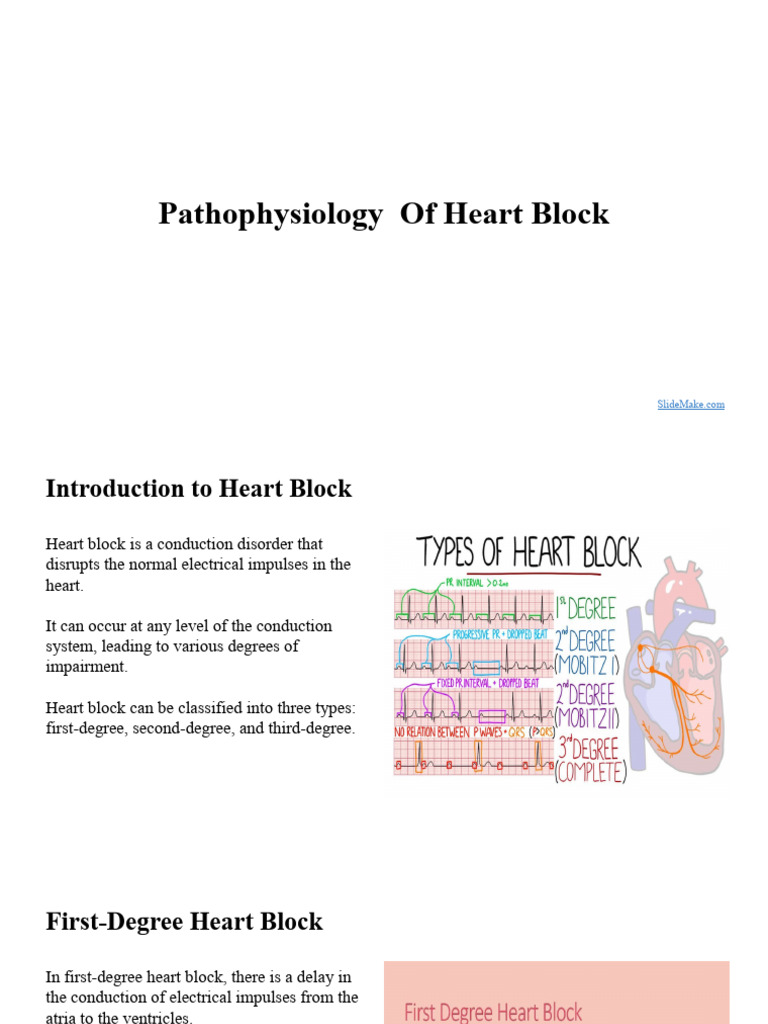 Pathophysiology of Heart Block | Download Free PDF | Heart ...