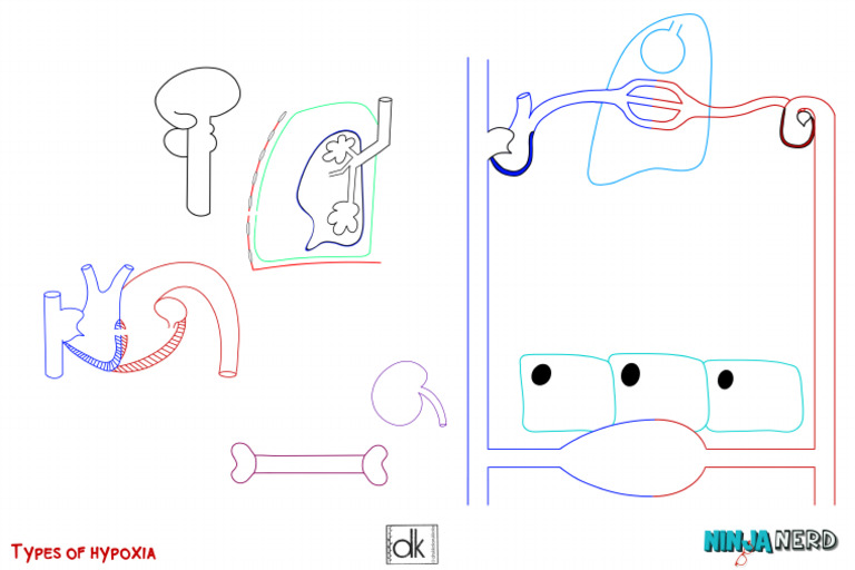 Respiratory Physiology) 13 Types of Hypoxia) - Handout | PDF