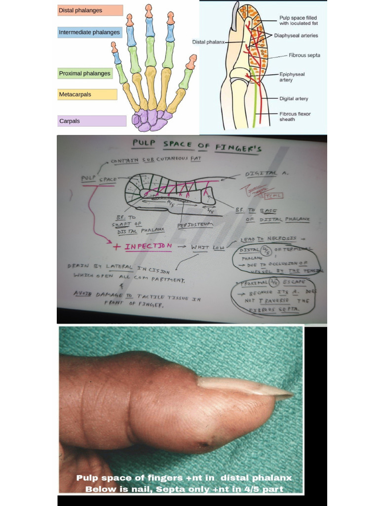 Pulp Space of Fingers | PDF