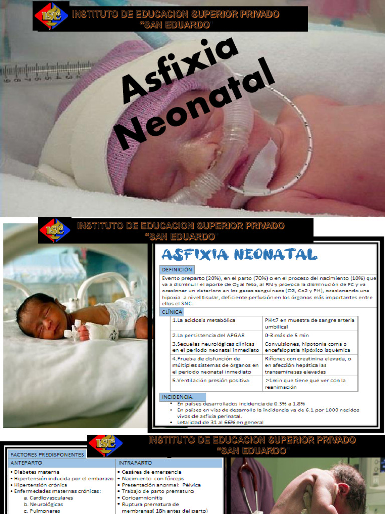 Tema Asfixia Neonatal PDF | PDF | Parto | El embarazo