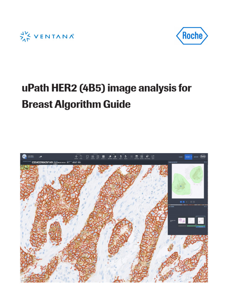 Roche Upath IVD Algorithm Guide | PDF | Immunohistochemistry | Usb ...