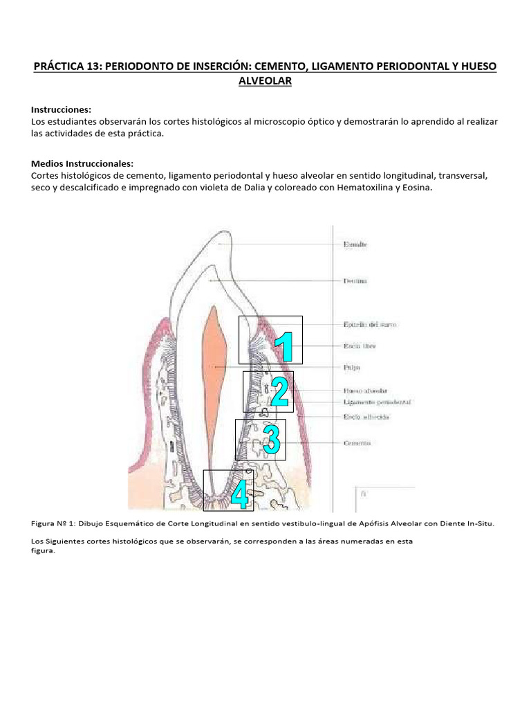 Periodonto de Inserción: Cemento, Ligamento Periodontal y Hueso Alveola ...