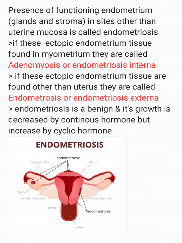 Endometrosis by Akshat | PDF